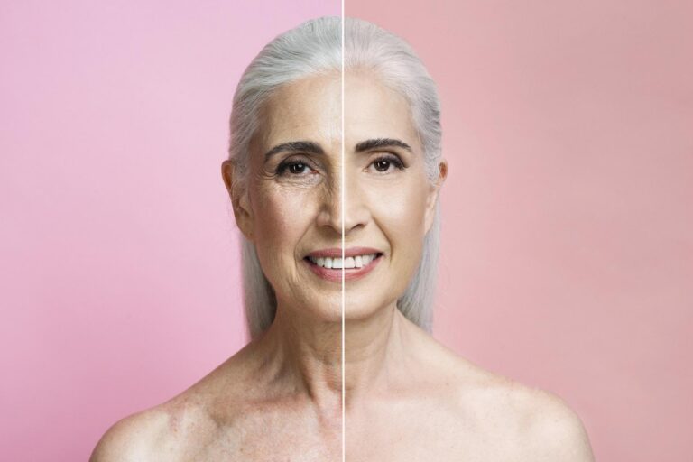 Fine Lines vs. Wrinkles: What’s the Difference and How to Treat Them ...